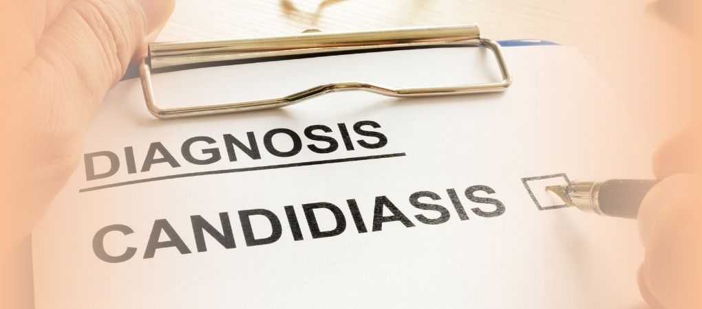 Candidose - Osteopedia - le portail web mondial de l'ostéopathie