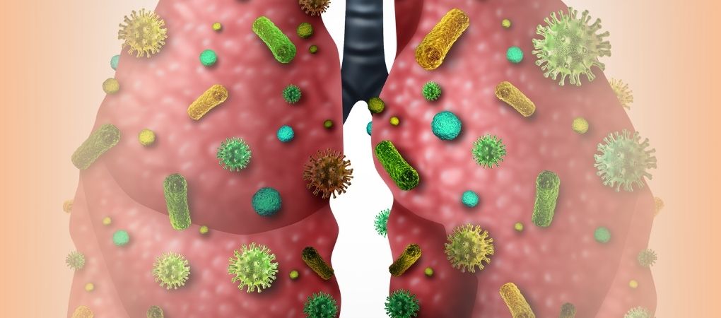 Bronchite - Osteopedia - le portail web mondial de l'ostéopathie